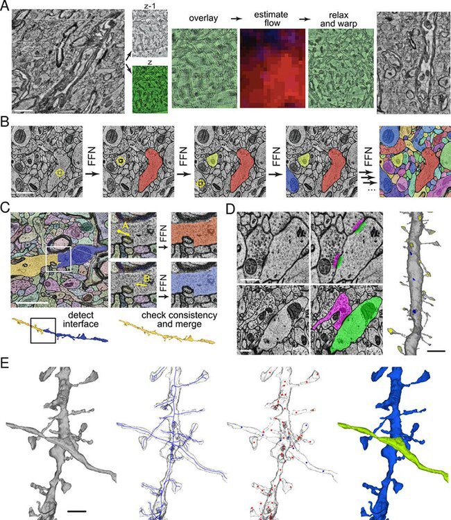 Google and Harvard Team Up to Make the Most Detailed Map of Human Brain ...